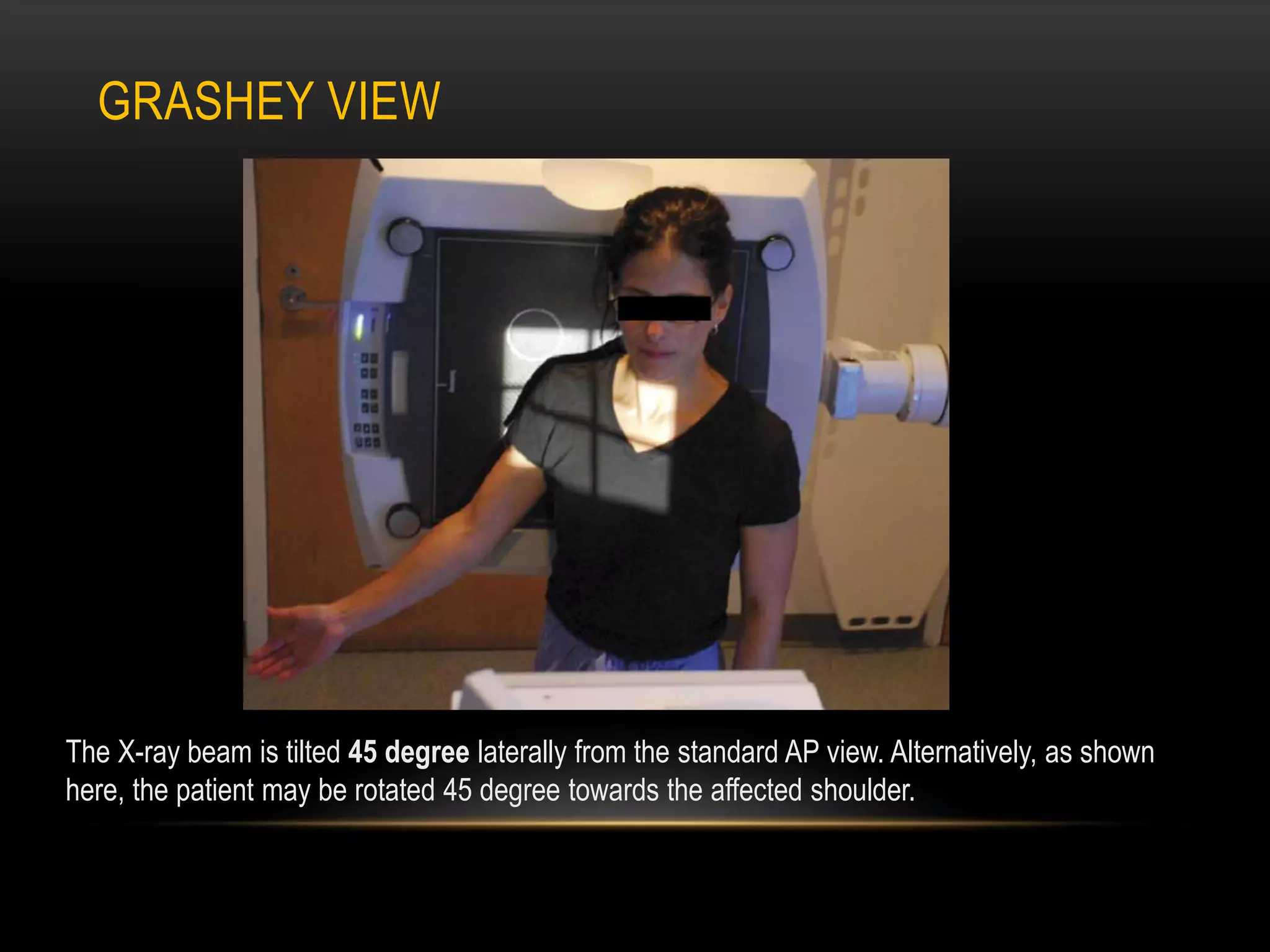 Radiographic evaluation of shoulder | PPTX