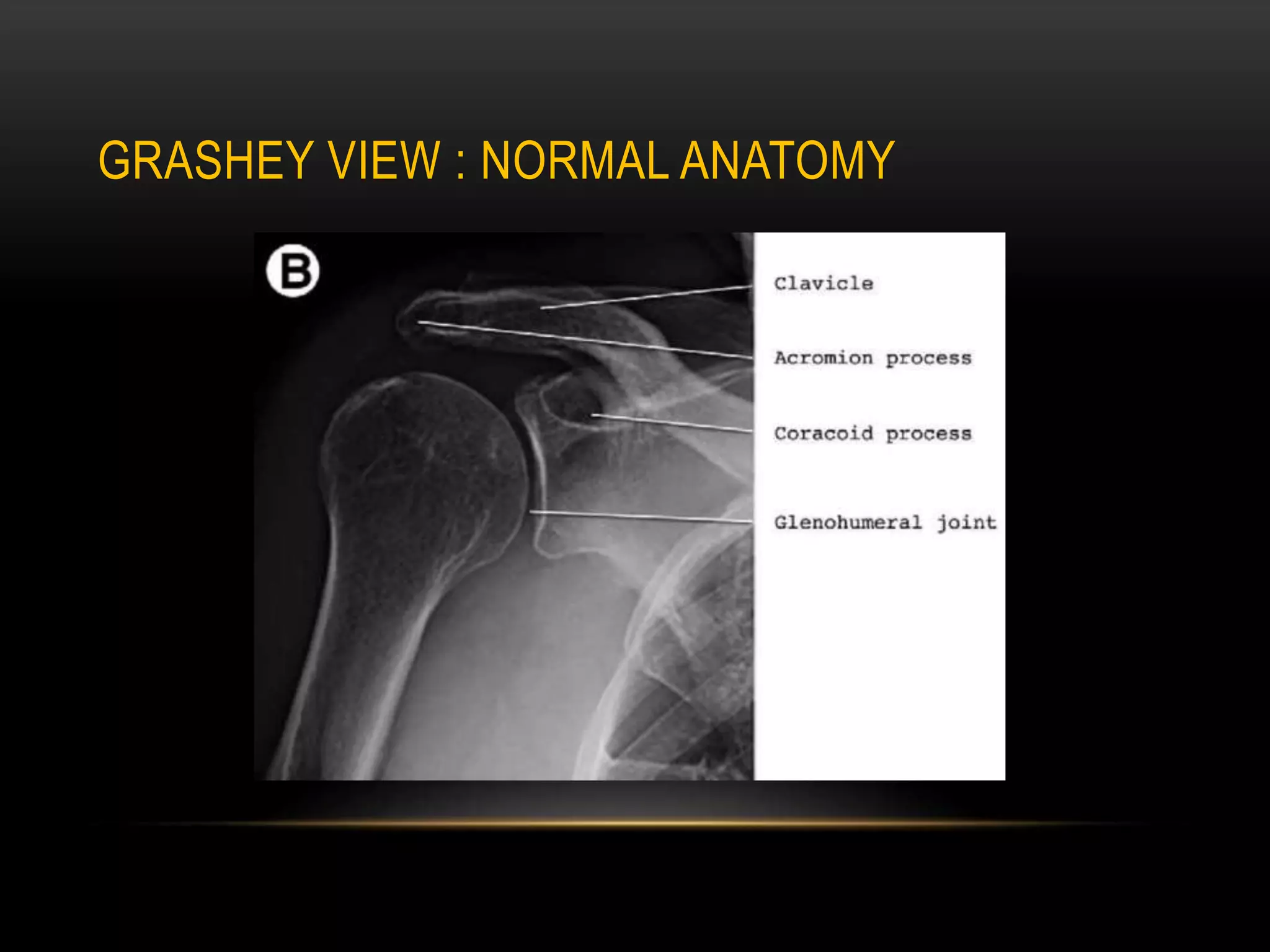 Radiographic evaluation of shoulder | PPTX