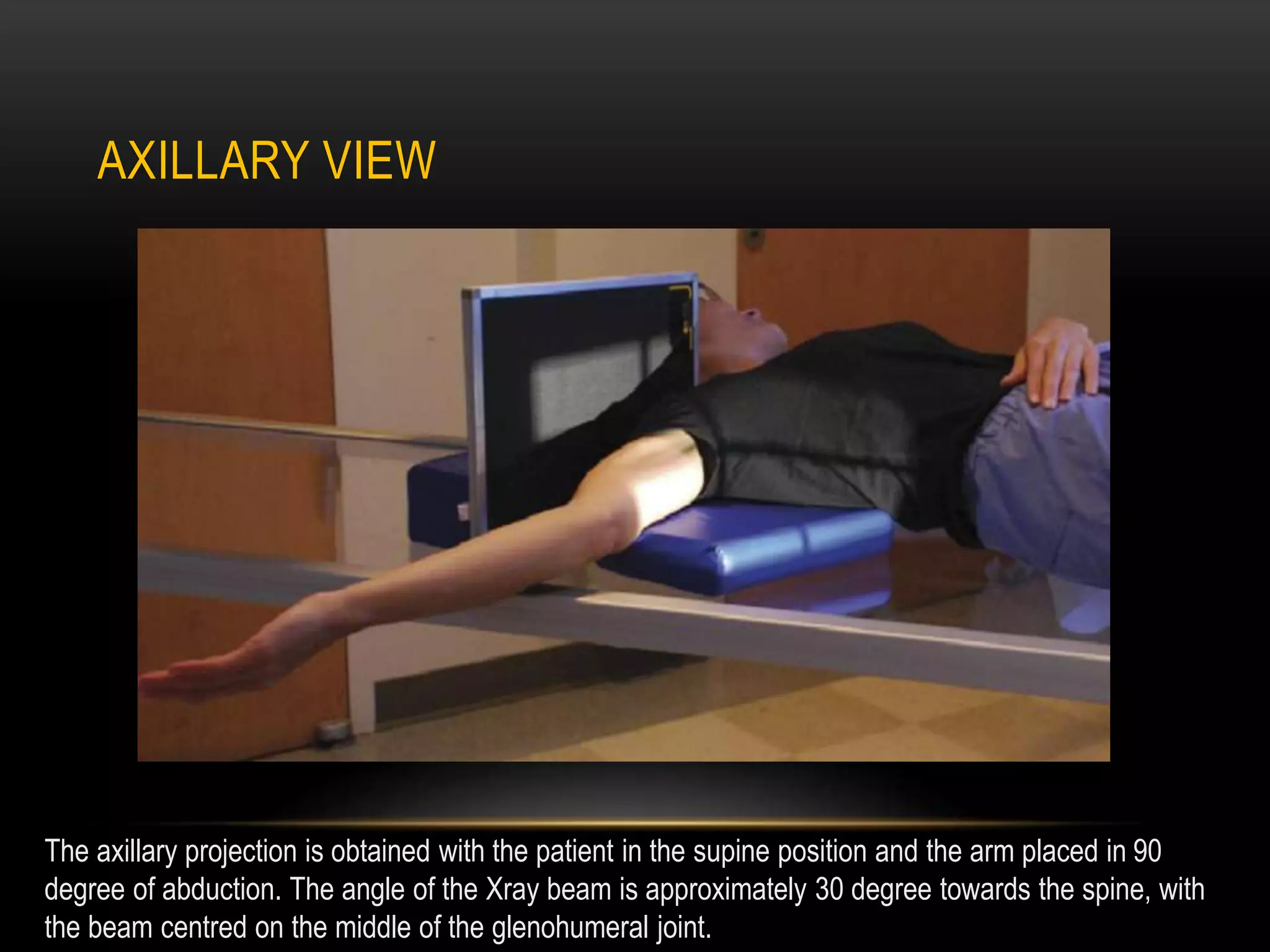 Radiographic evaluation of shoulder | PPTX