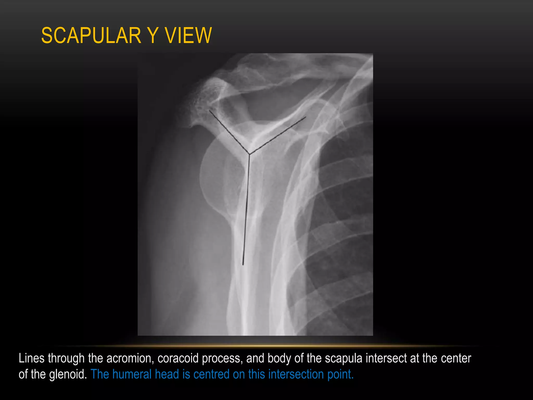 Radiographic evaluation of shoulder | PPTX
