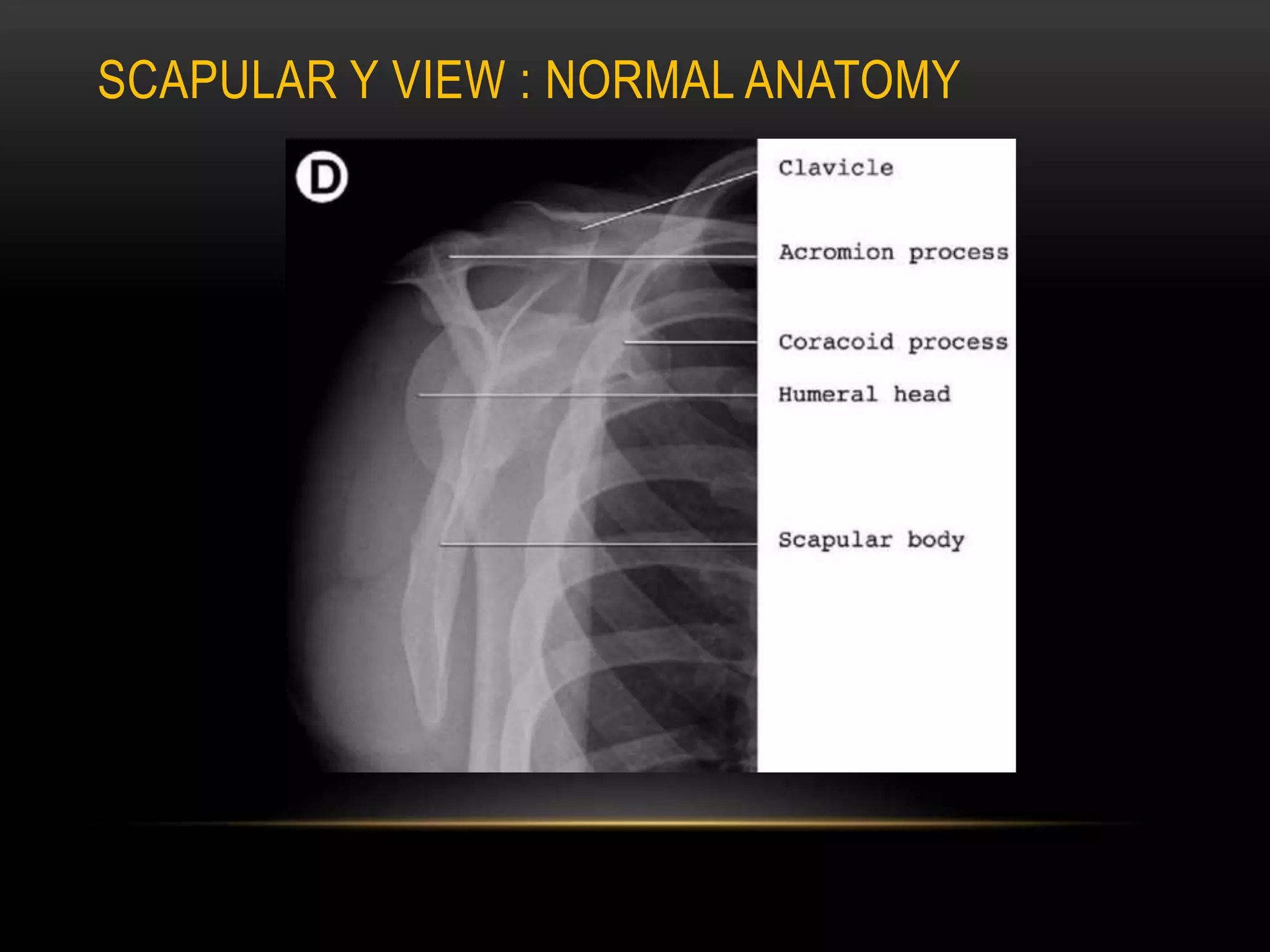 Radiographic evaluation of shoulder | PPTX