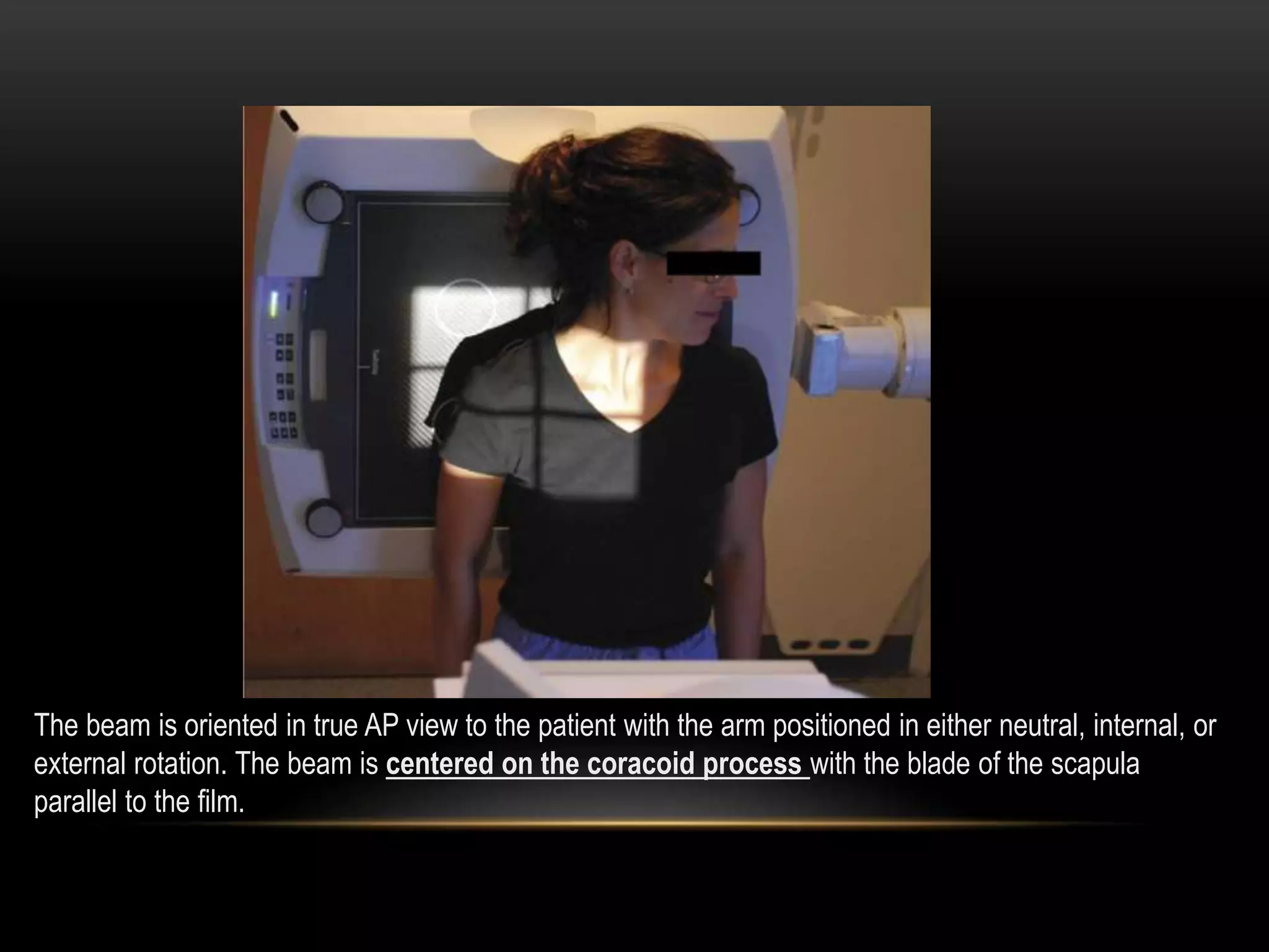 Radiographic evaluation of shoulder | PPTX