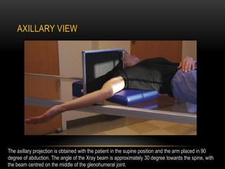 Radiographic evaluation of shoulder | PPTX