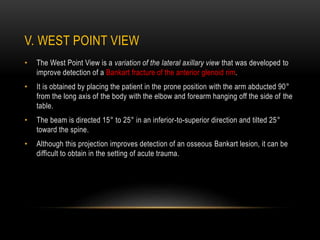 Radiographic evaluation of shoulder | PPTX