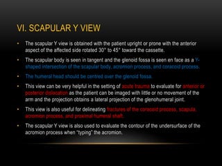 Radiographic evaluation of shoulder | PPTX