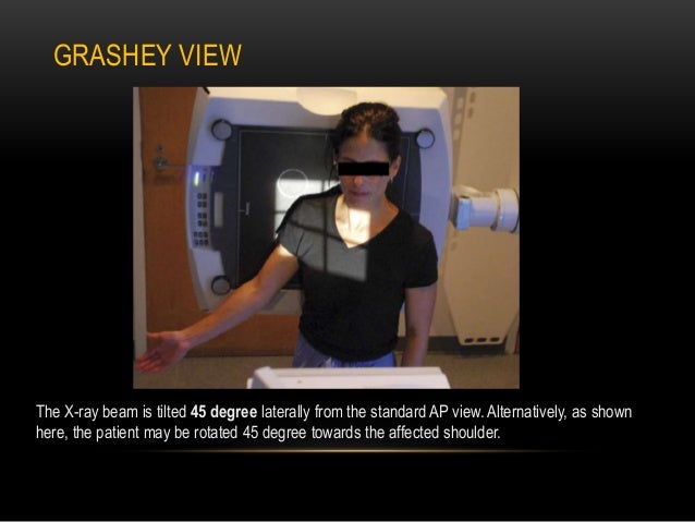 Radiographic evaluation of shoulder