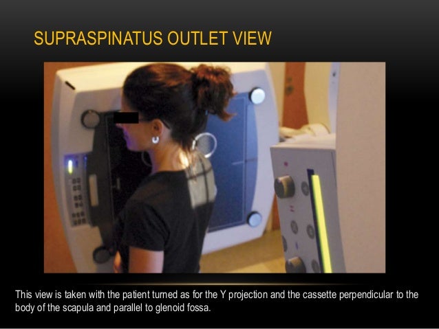 Supraspinatus Outlet View Shoulder X Ray | semashow.com