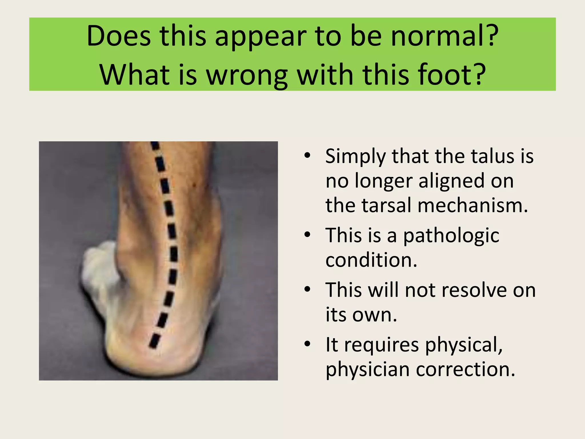 TaloTarsal Dislocation - Radiographic Evidence | PPTX
