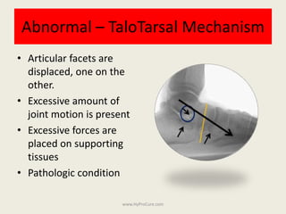 TaloTarsal Dislocation - Radiographic Evidence | PPTX