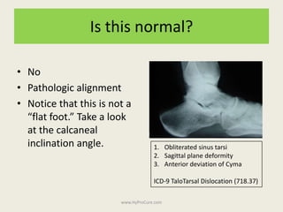 TaloTarsal Dislocation - Radiographic Evidence | PPTX