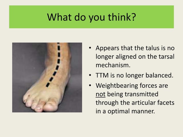 TaloTarsal Dislocation - Radiographic Evidence