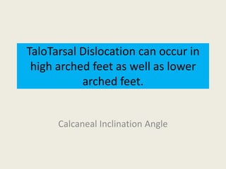 TaloTarsal Dislocation - Radiographic Evidence
