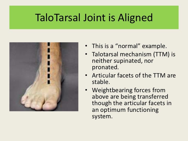 TaloTarsal Dislocation - Radiographic Evidence