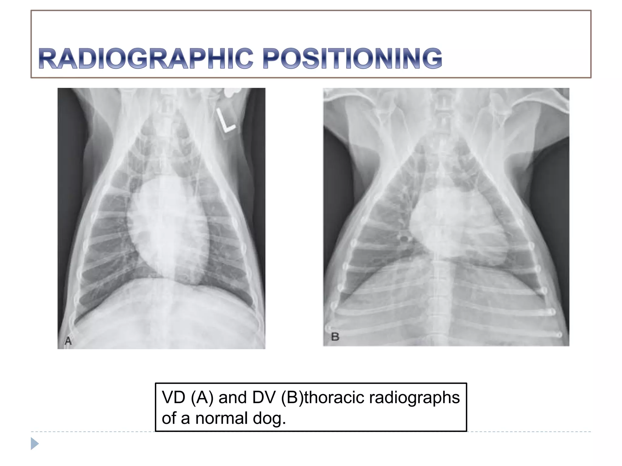Radiographic Examination of Cardiovascular System | PPTX