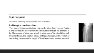 Radiographic Examination of the Tibia and Fibula.pptx