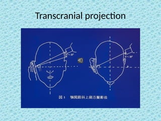 RADIOGRAPHIC EXAMINATION OF TMJ.pptx. | PPTX