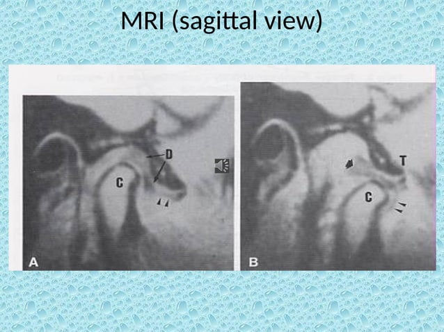 RADIOGRAPHIC EXAMINATION OF TMJ.pptx. | PPT