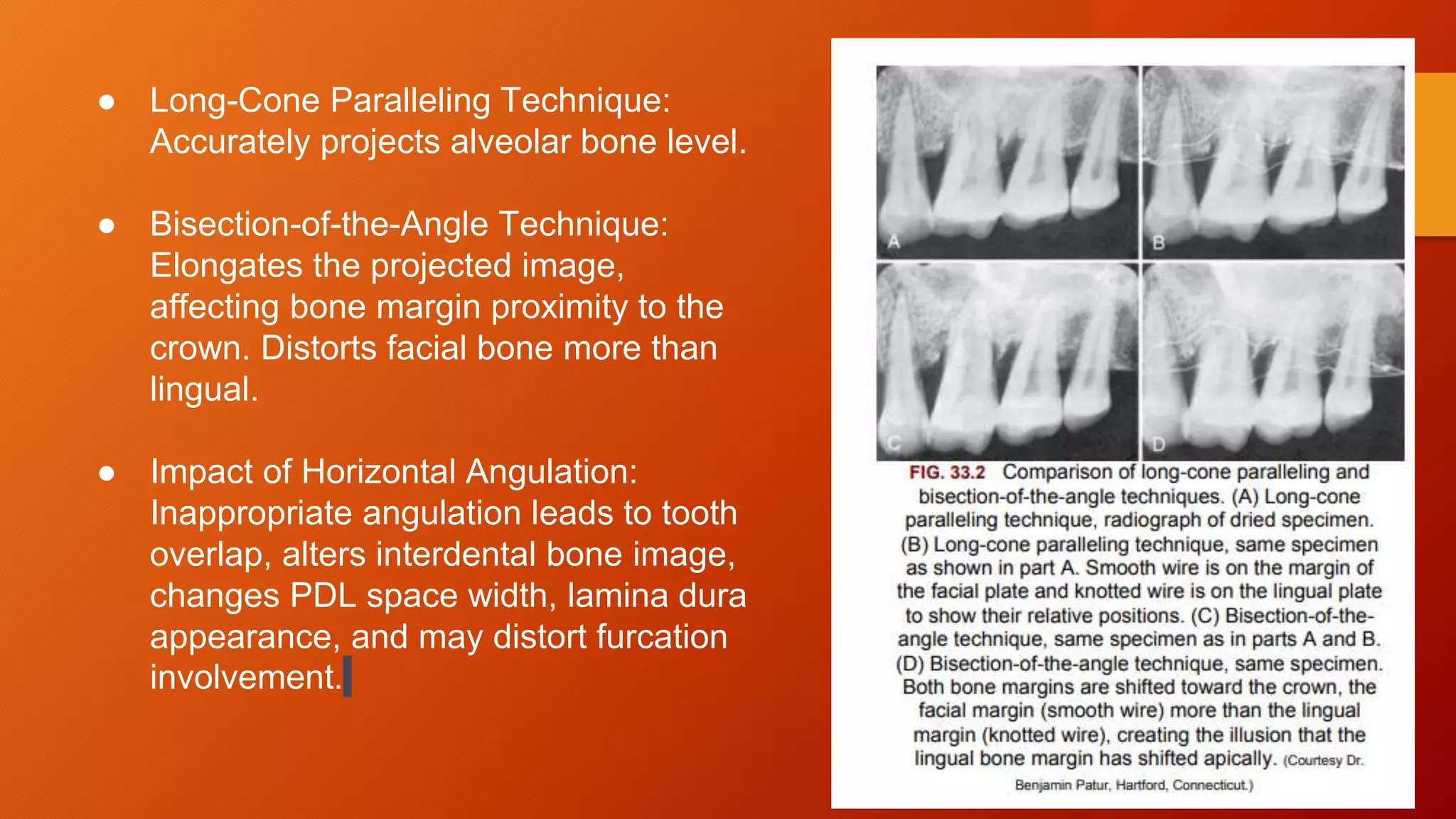 RADIOGRAPHIC EXAMINATIONS OF BONE LOSS AND PATTERN OF BONE LOSS | PPTX