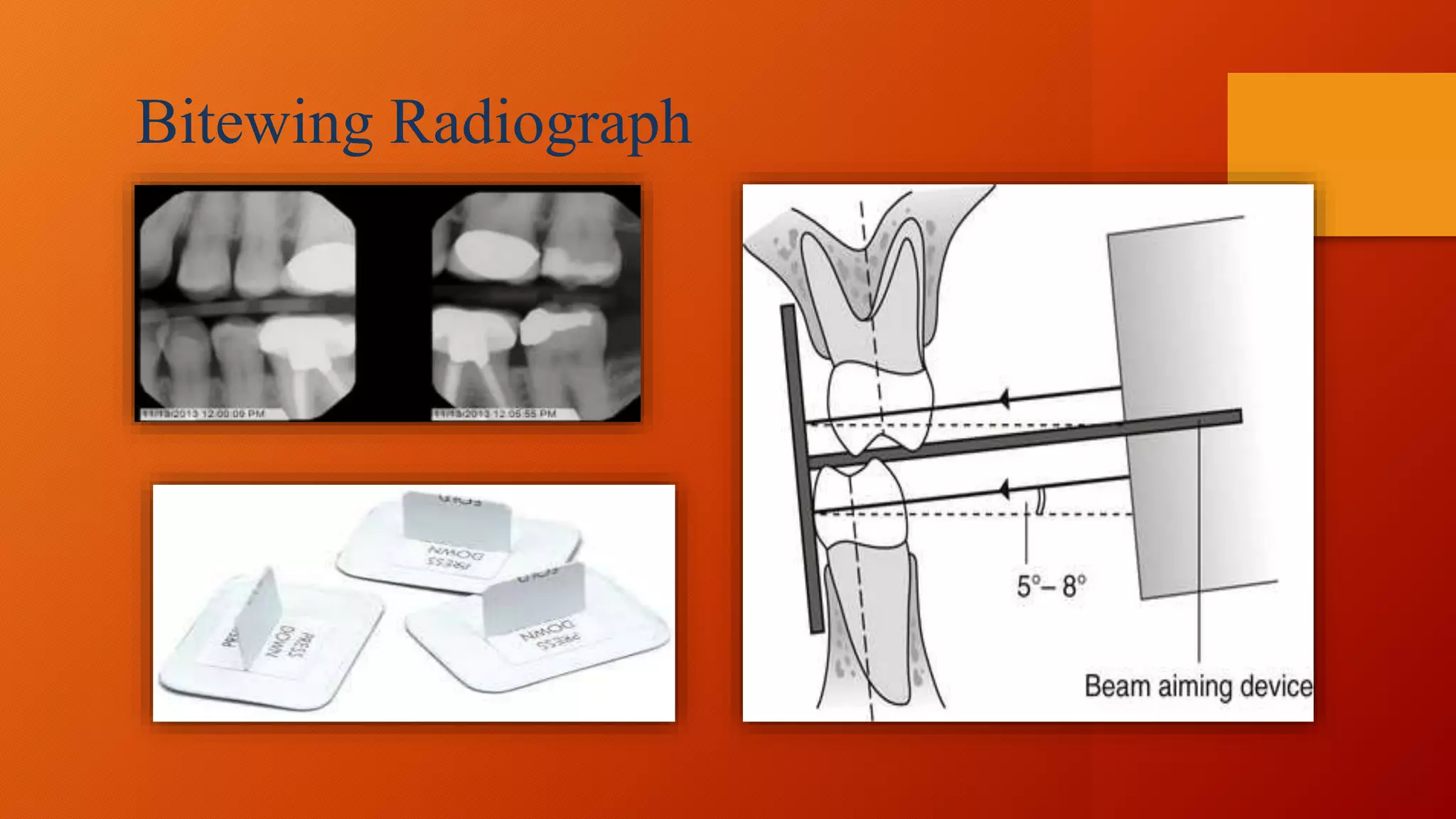 RADIOGRAPHIC EXAMINATIONS OF BONE LOSS AND PATTERN OF BONE LOSS | PPTX