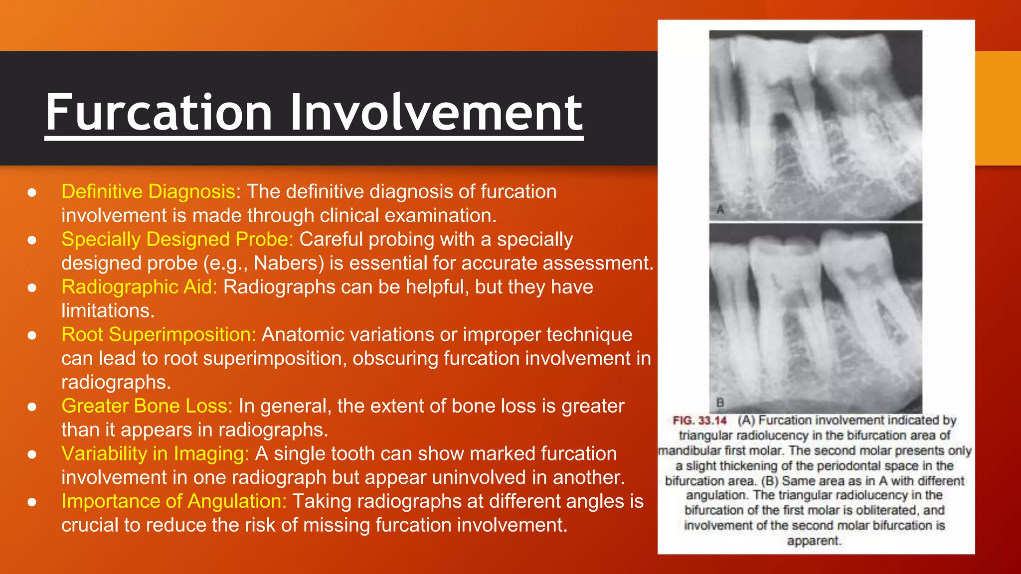 RADIOGRAPHIC EXAMINATIONS OF BONE LOSS AND PATTERN OF BONE LOSS | PPTX