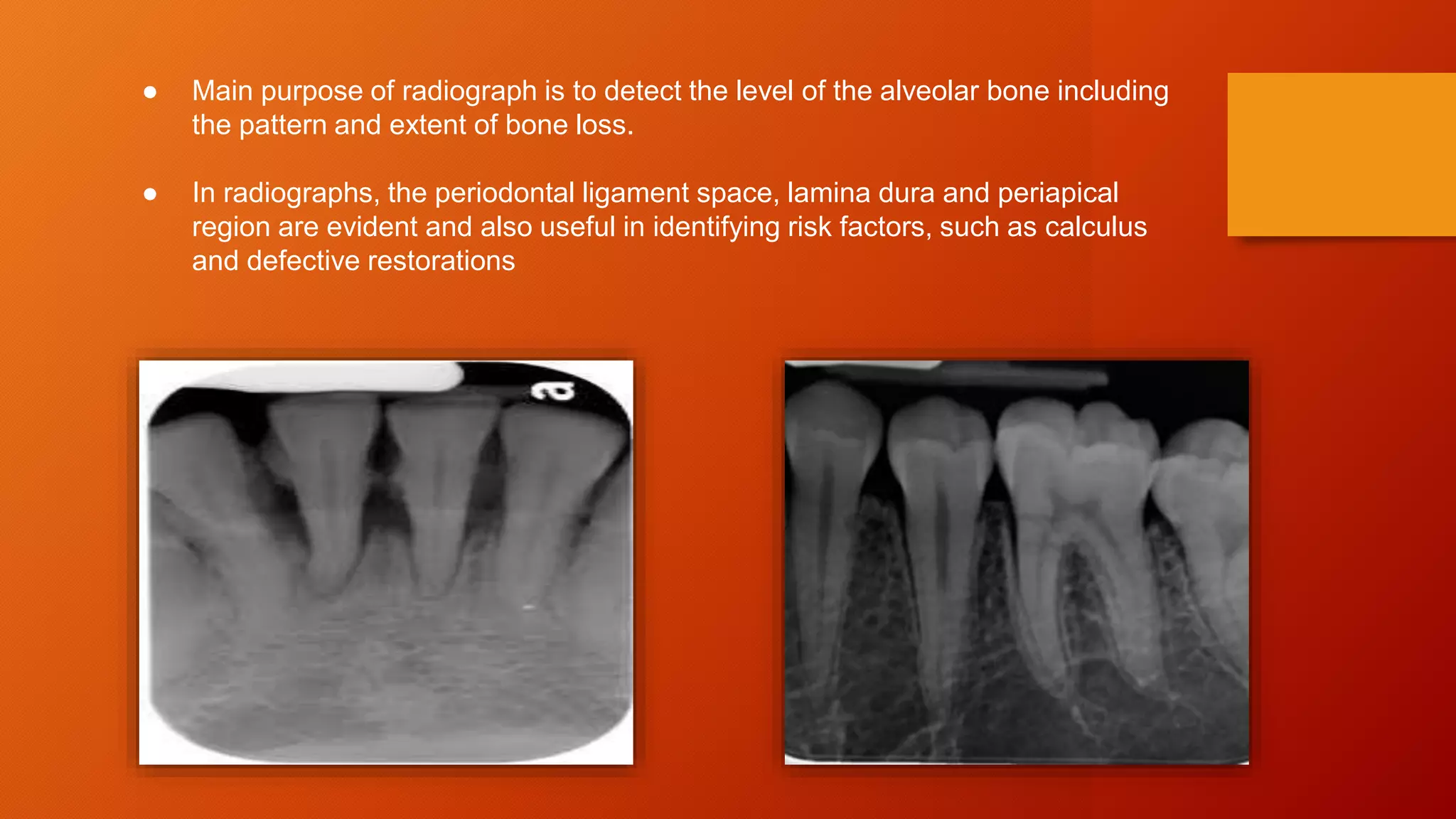 RADIOGRAPHIC EXAMINATIONS OF BONE LOSS AND PATTERN OF BONE LOSS | PPTX