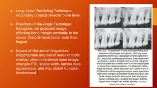 RADIOGRAPHIC EXAMINATIONS OF BONE LOSS AND PATTERN OF BONE LOSS | PPTX