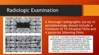 RADIOGRAPHIC EXAMINATIONS OF BONE LOSS AND PATTERN OF BONE LOSS | PPTX
