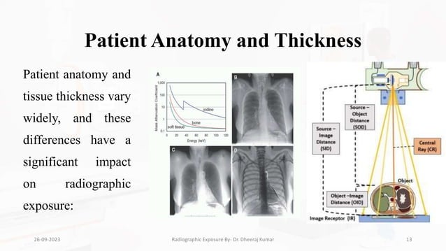 Radiographic Exposure.pptx | Photography | Arts and Crafts