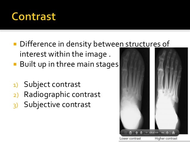 Radiographic factor