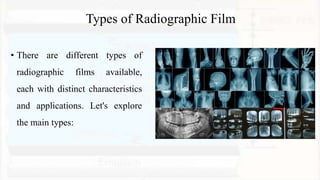 Radiographic Film.pptx