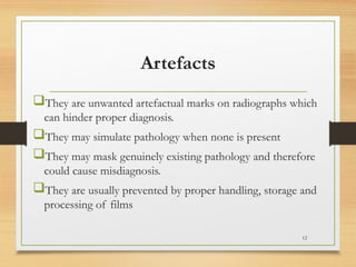 Radiographic Film Faultsand how they can be avoided | PPTX