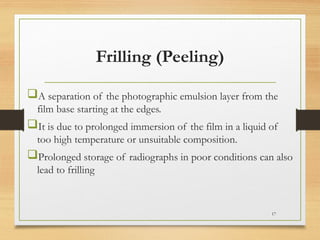 Radiographic Film Faultsand how they can be avoided | PPTX