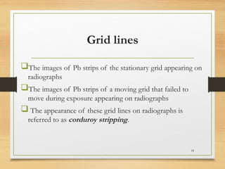 Radiographic Film Faultsand how they can be avoided | PPTX