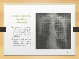 Radiographic Film Faultsand how they can be avoided | PPTX