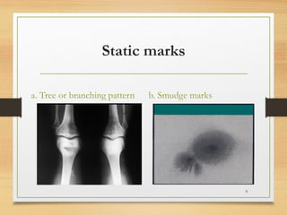Radiographic Film Faultsand how they can be avoided | PPTX