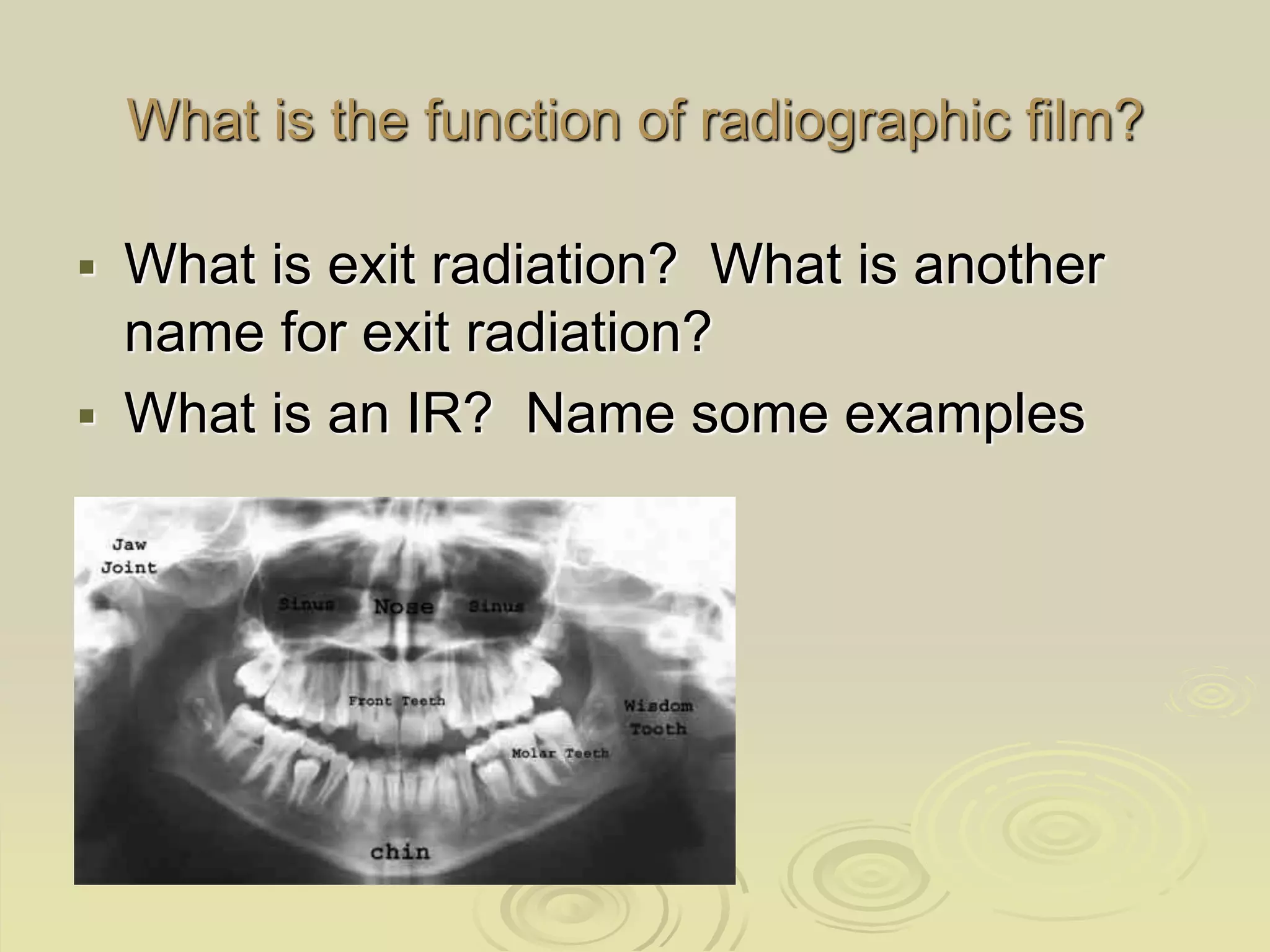 Radiographic film & intensifying screens w10 | PPT