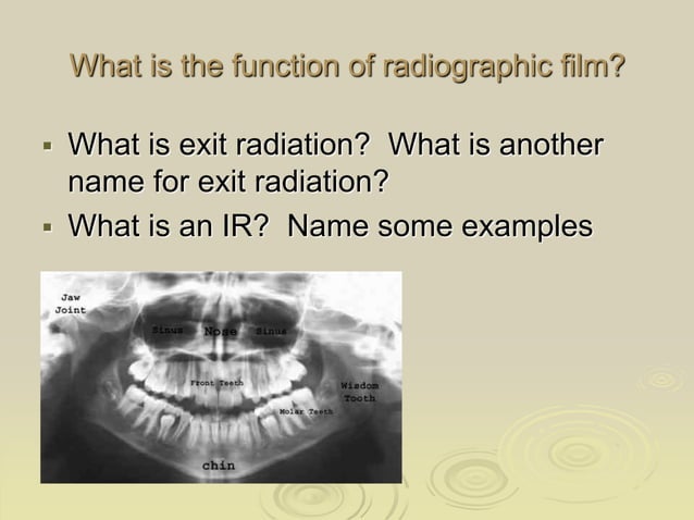 Radiographic film & intensifying screens w10 | PPTX