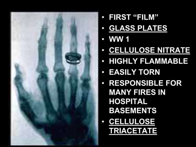 Radiographic film & intensifying screens w10 | PPTX