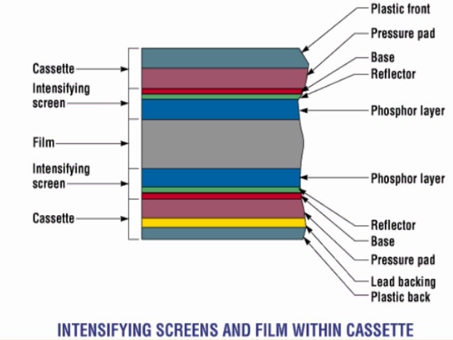 Radiographic film & intensifying screens w10