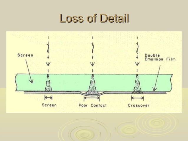 Radiographic film ; intensifying screens | PPT | Cameras and Camcorders ...