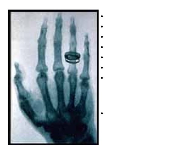 Radiographic film ; intensifying screens | PPT | Cameras and Camcorders ...