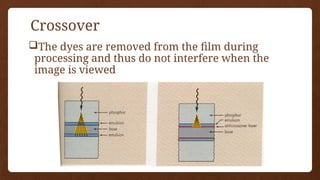 Conventional Radiographic Film and it's cross-sectional study sujan ...