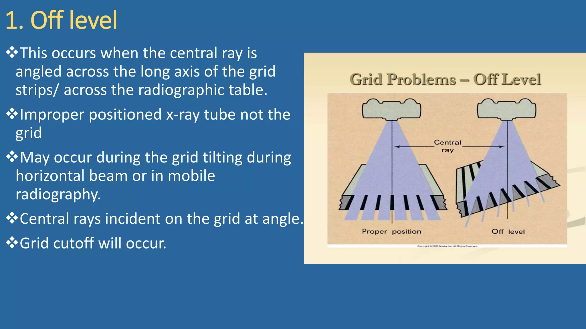 Radiographic grid Swastik | PPTX