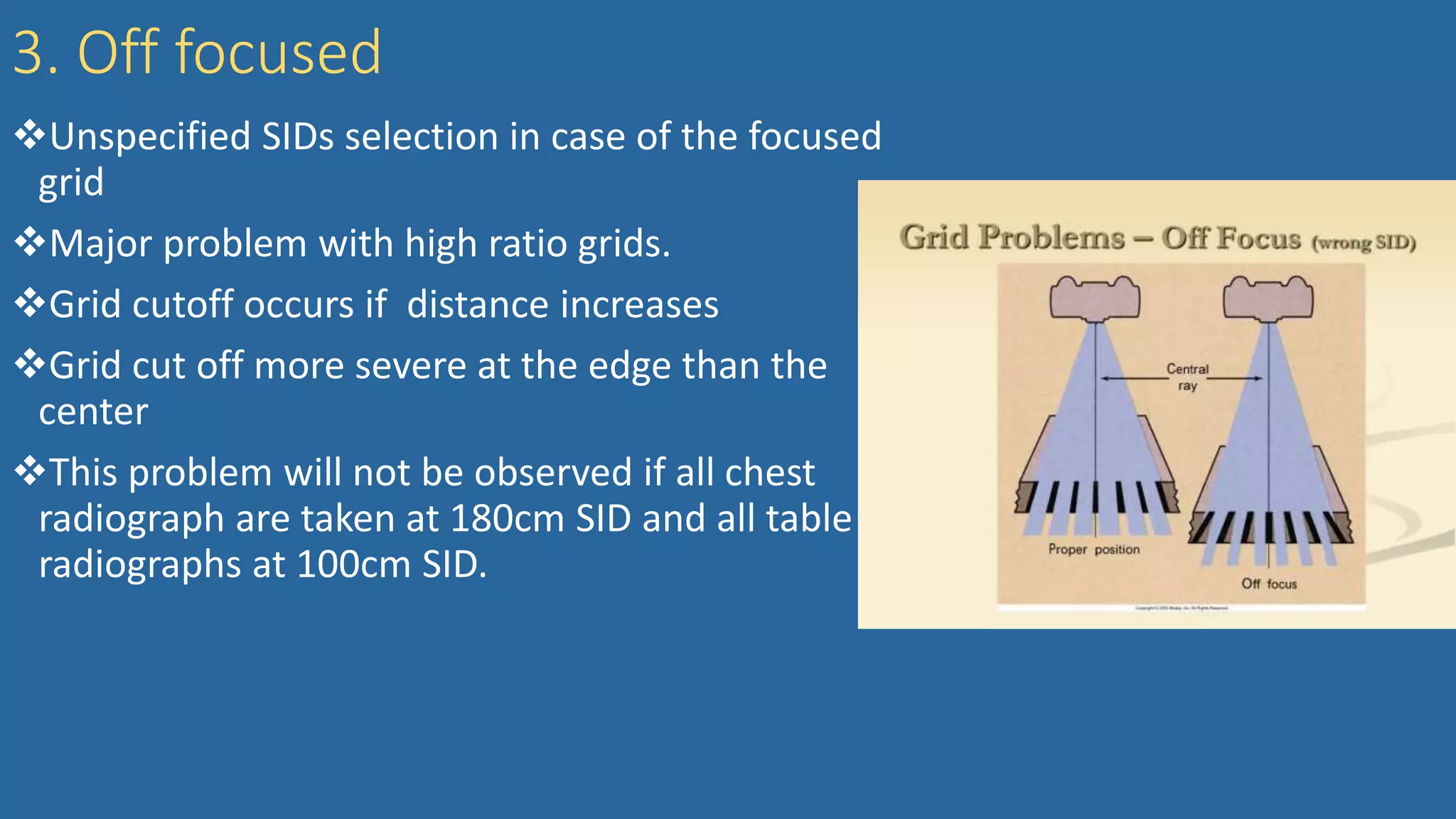 Radiographic grid Swastik | PPTX
