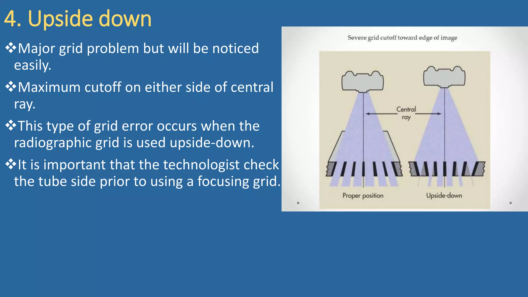 Radiographic grid Swastik | PPTX