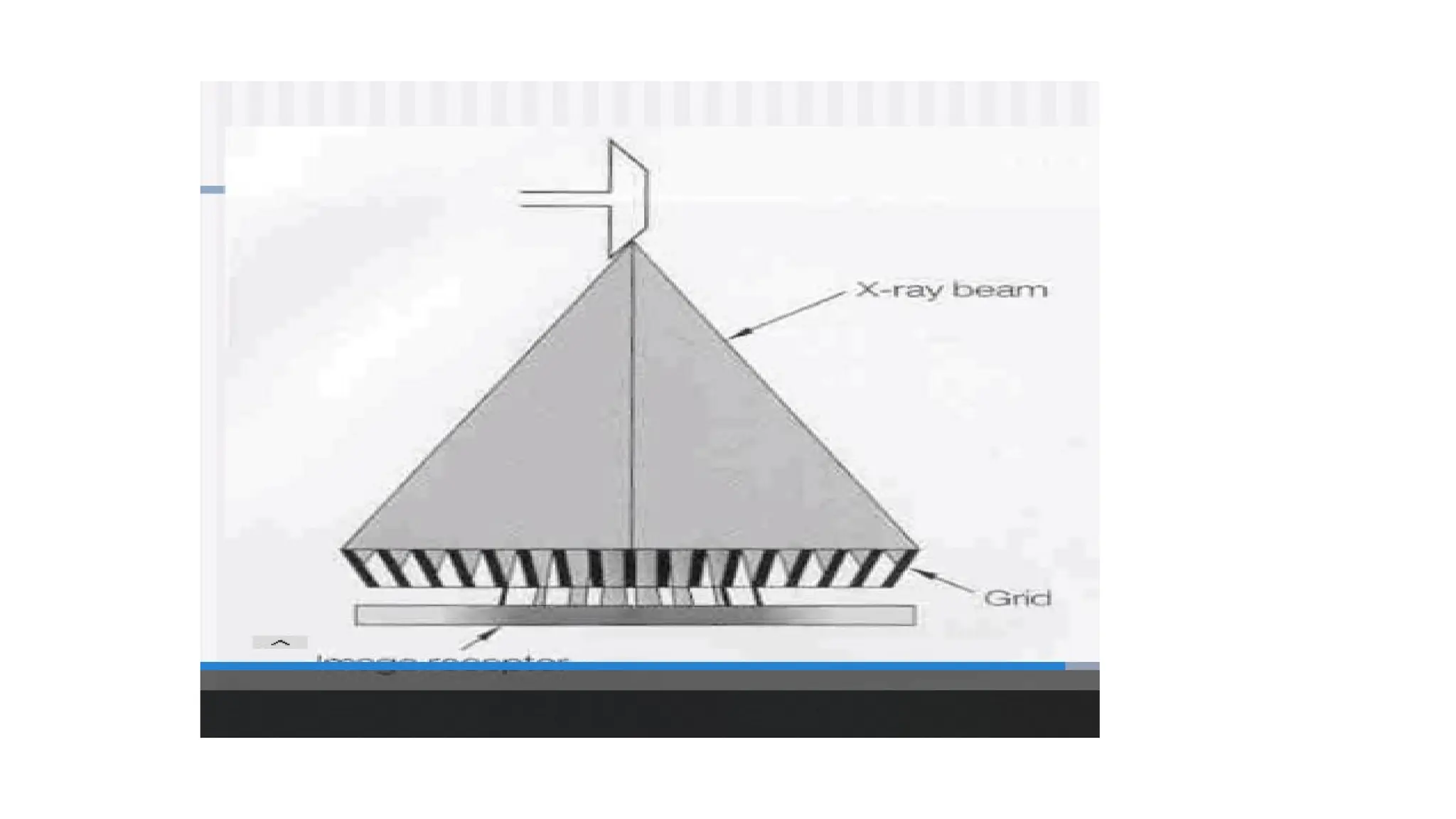 Radiographic grid uses and its types .pptx