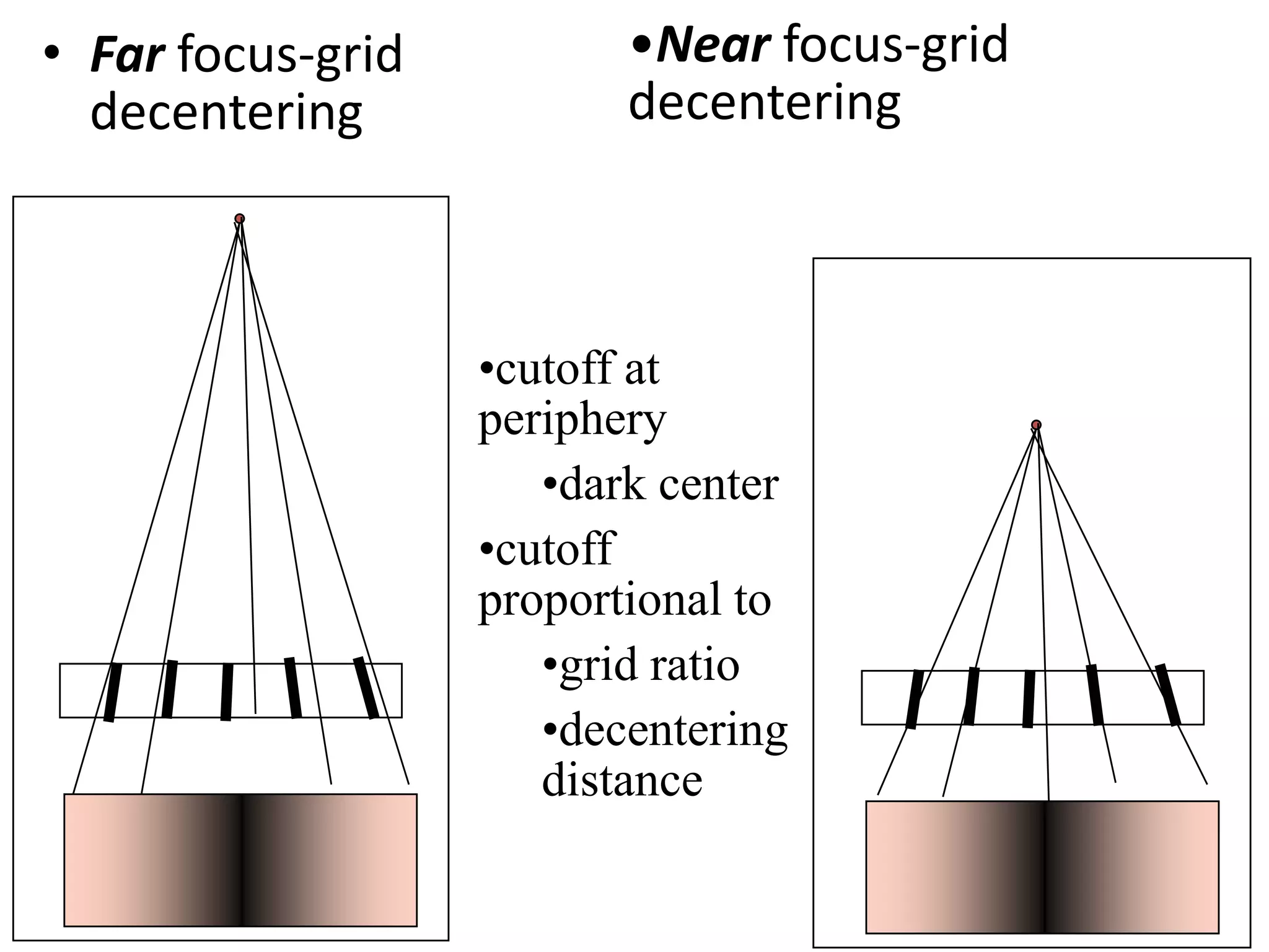 Radiographic grids | PPTX