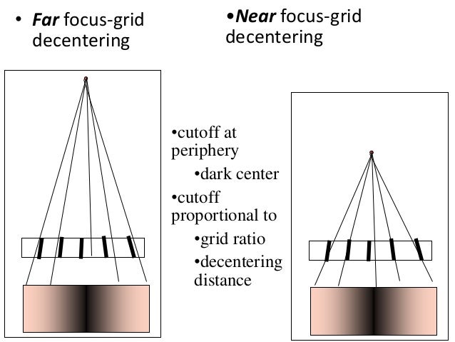 Radiographic grids