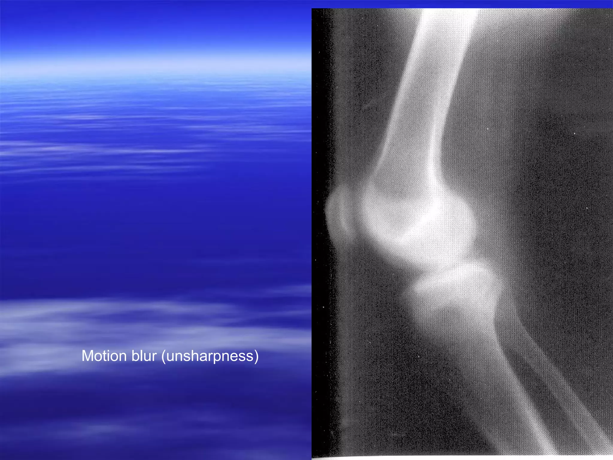 Radiographic image4 | PPT