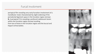 Radiographic interpretaion Assadawy ( legacy).pdf